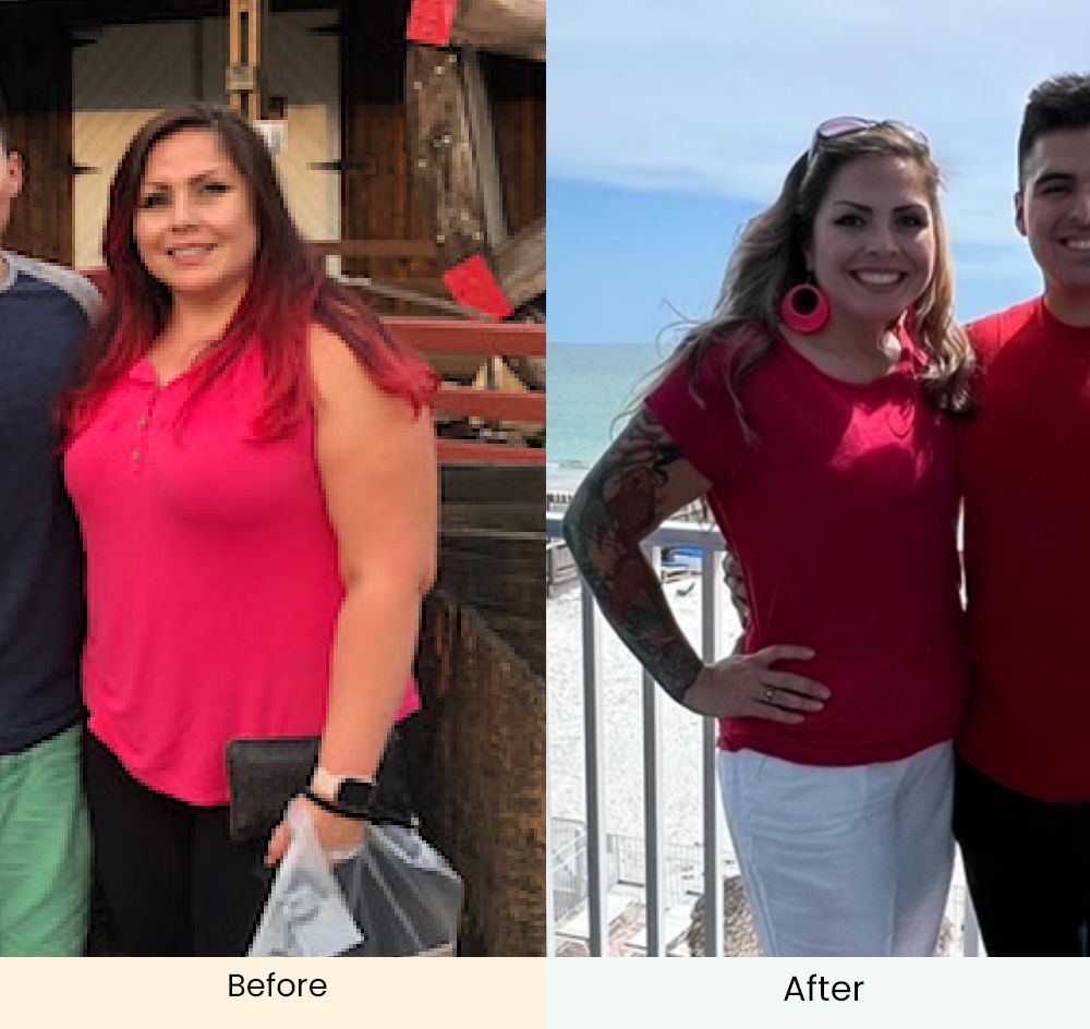 Lizs Bariatric Surgery Success Story Bass Bariatric Surgery Center